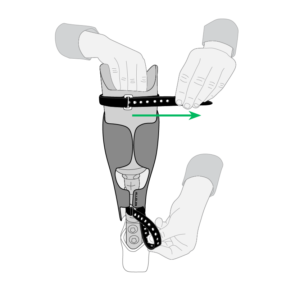 Below Knee Cover – ALLELES Design Studio